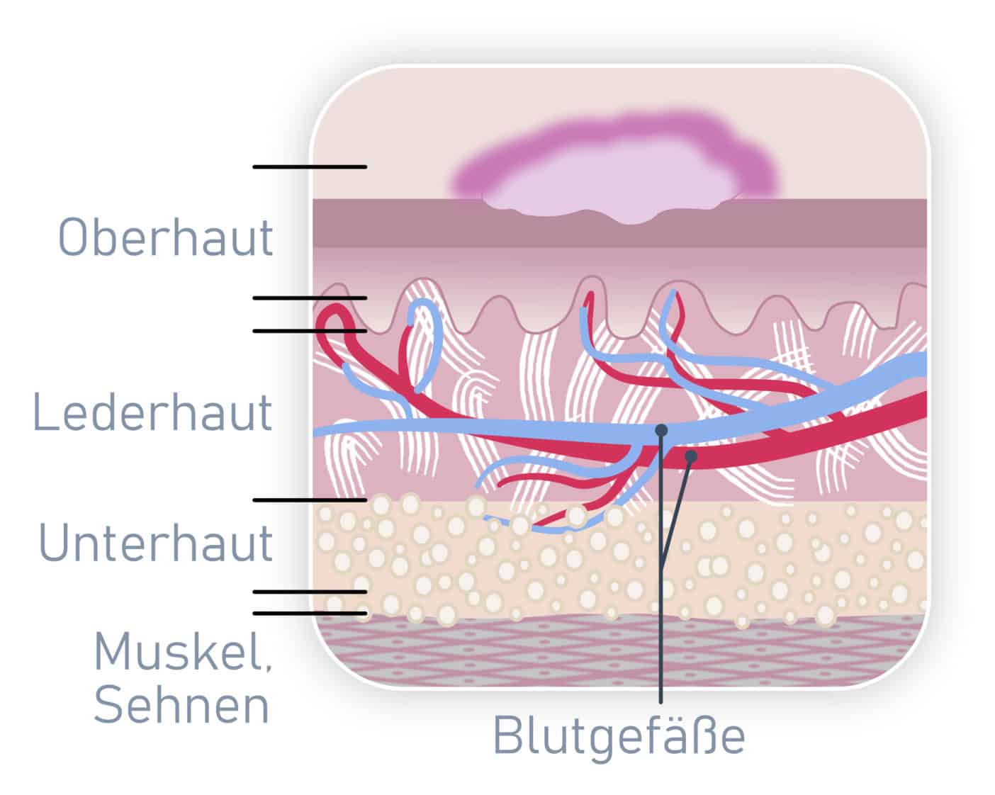 Narbenpflege - Panthenol - Aloe Vera - Zwiebelextrakt - Cosmacon