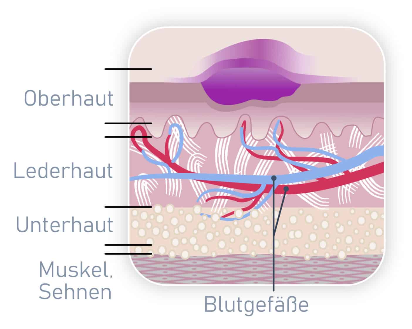 Narbenpflege - Panthenol - Aloe Vera - Zwiebelextrakt - Cosmacon
