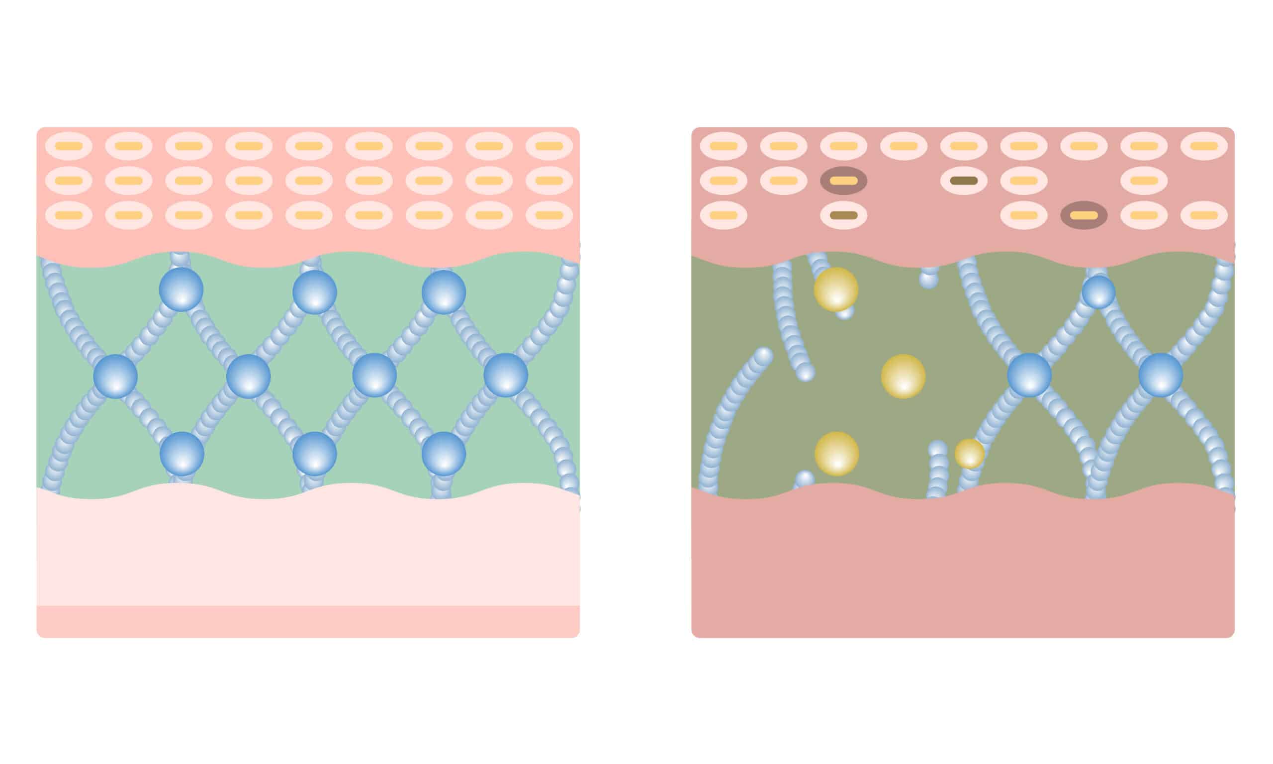 Hautbarriere - NMF - Trimoist - AquaCacteen - Cosmacon