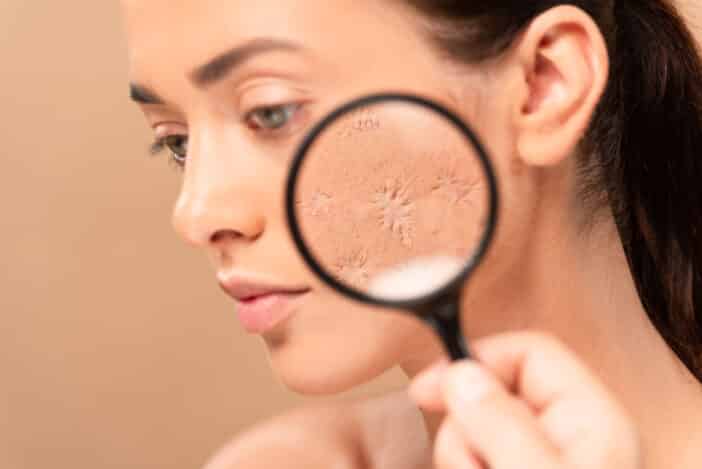 Scar therapy: ways to achieve smoother skin and greater well-being ...